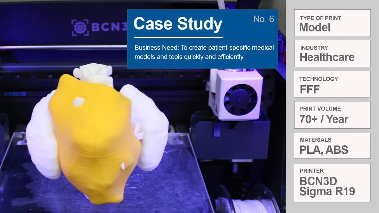 Case Study: Why Hospitals Need 3D Printers - BCN3D Technologies